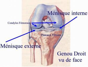 Quel sport avec ménisque fissuré ? Tu vas le savoir ici